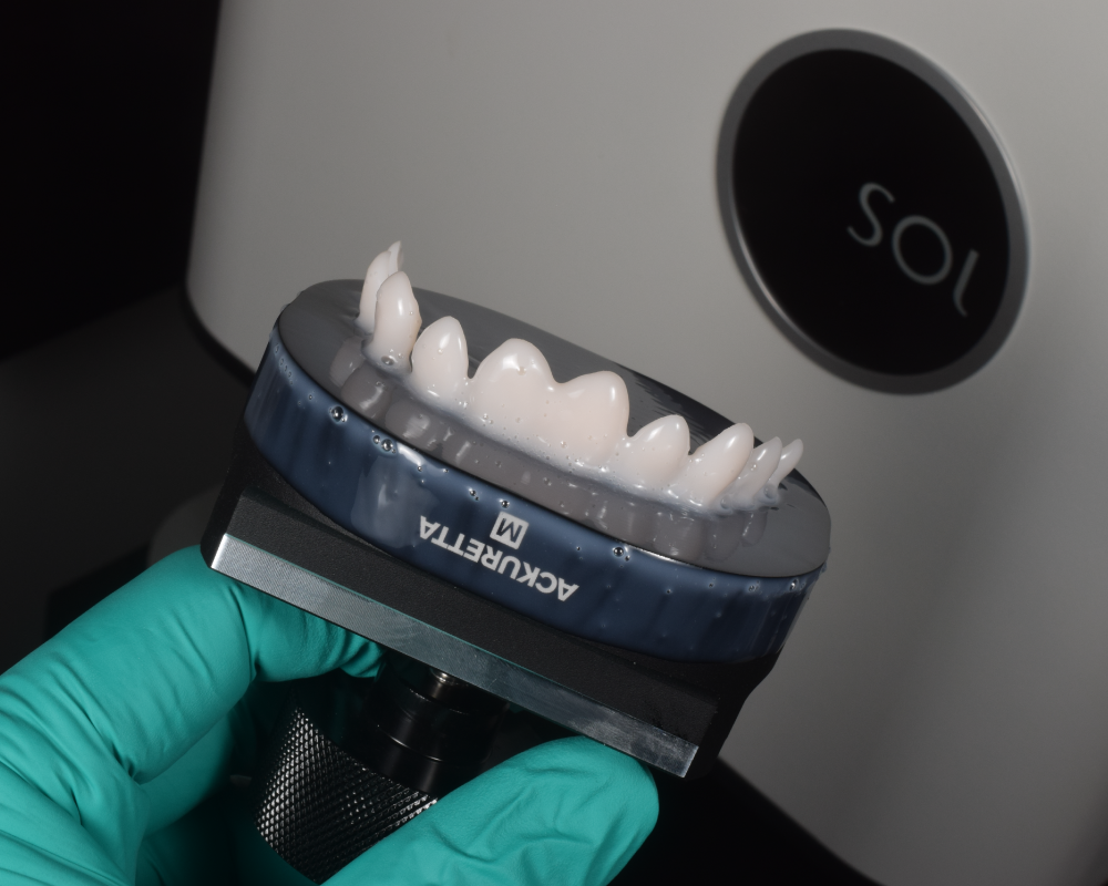 3D Printed Veneers with Ackuretta SOL & Pac-Dent Rodin Titan