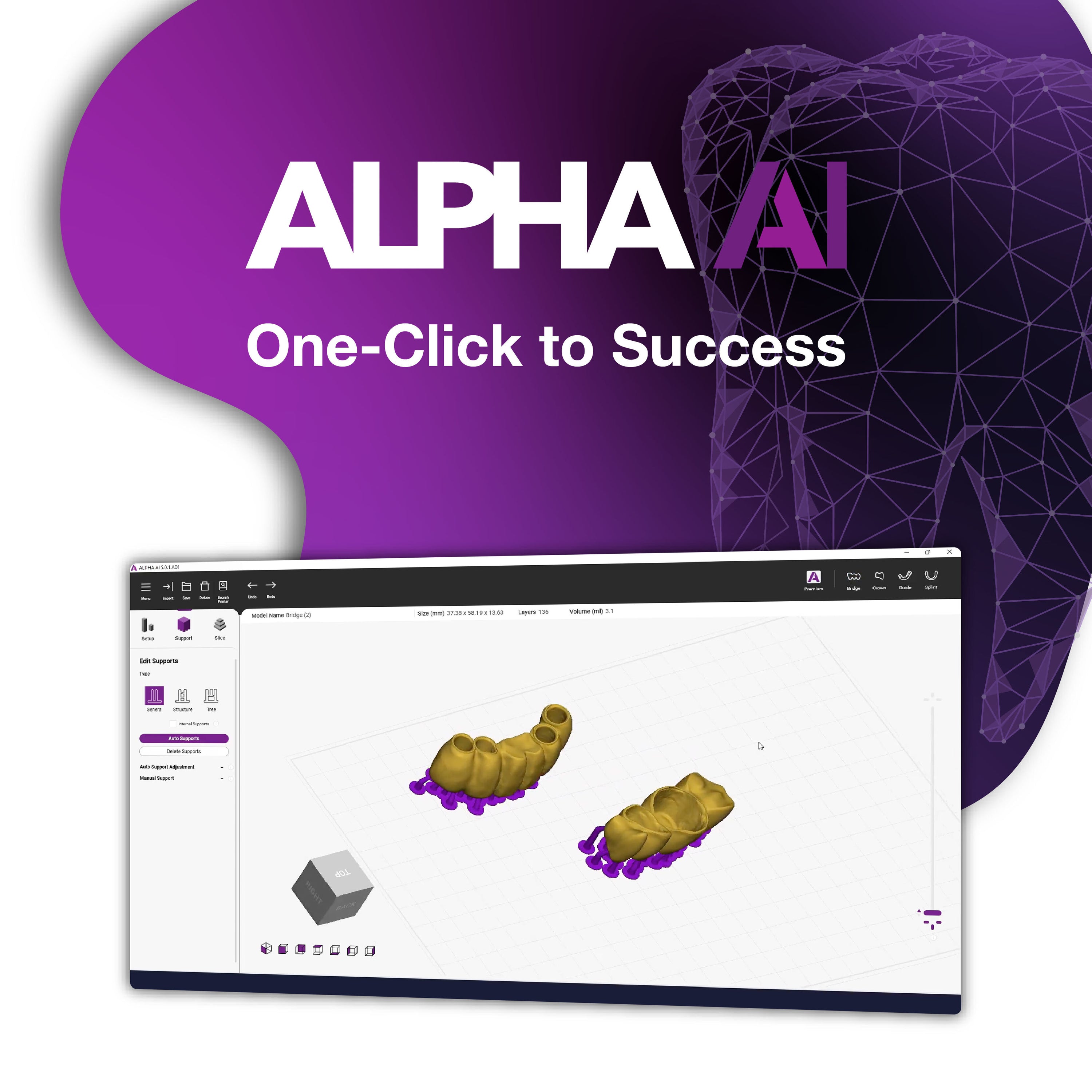 Introducing ALPHA AI: Ackuretta’s AI-driven 3D slicing software