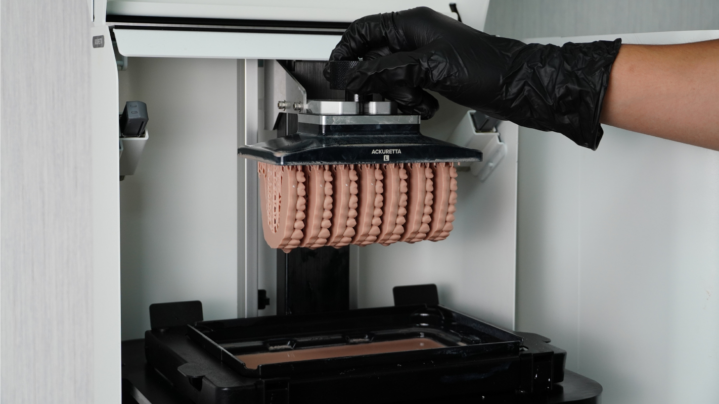 Top Uses of 3D Printed Dental Models in Digital Dentistry